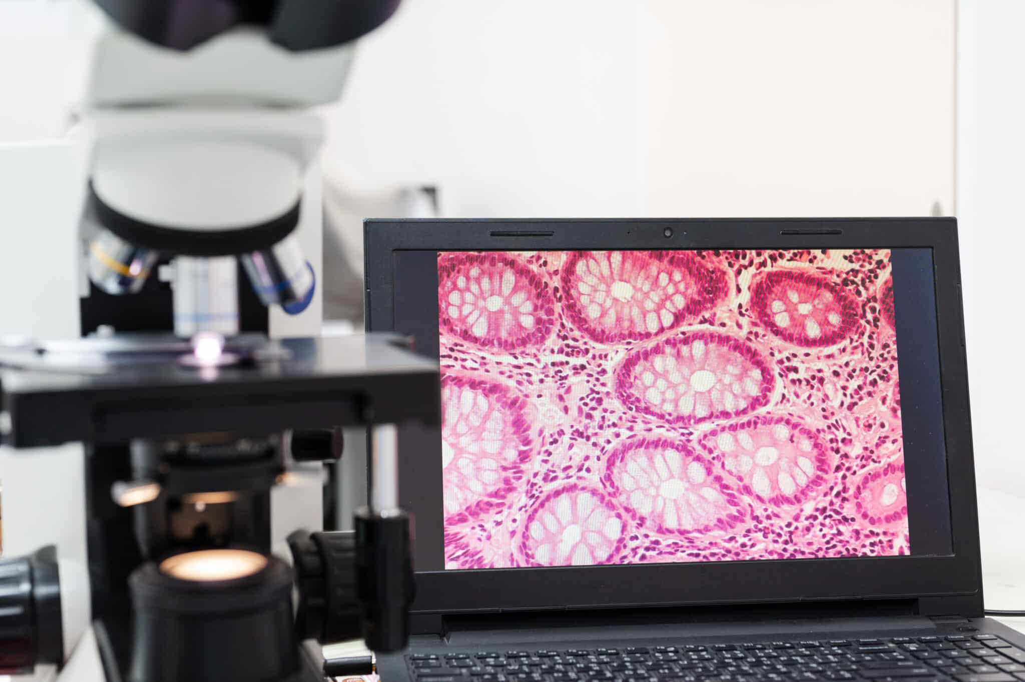 Spectroscopic Precision: Elevating Tissue Identification - Avantes